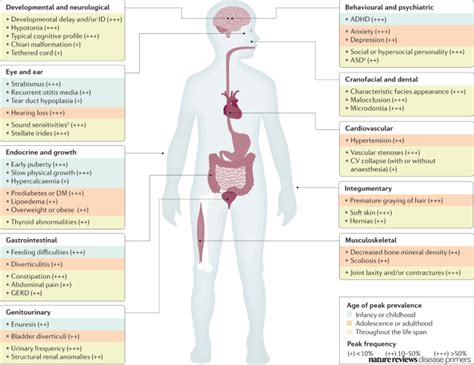Nature Reviews Disease Primers On Twitter Williamssyndrome Can