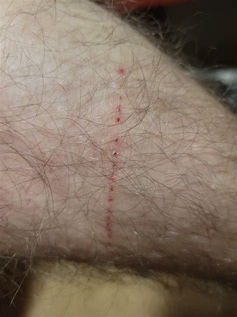 Red Dots In A Line R Skin