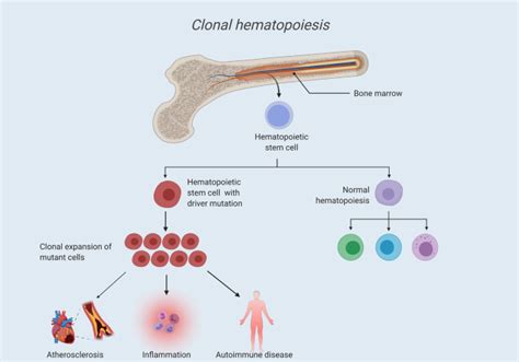 克隆造血和血管疾病seminars In Immunopathology X Mol