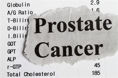Prostate Cancer Screening Guidelines Can Confuse Clinicians