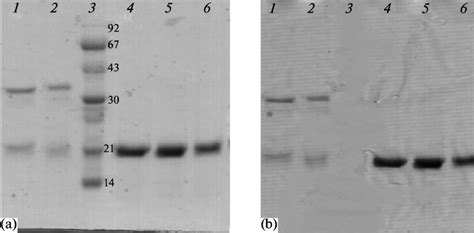 A Electrophoretic Pattern And B Immunoblot Of The Specimens Of The