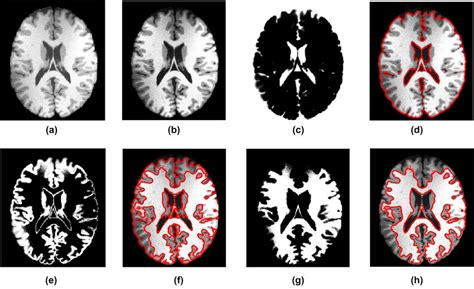 segmented mri brain tissues a b original brain image and enhanced