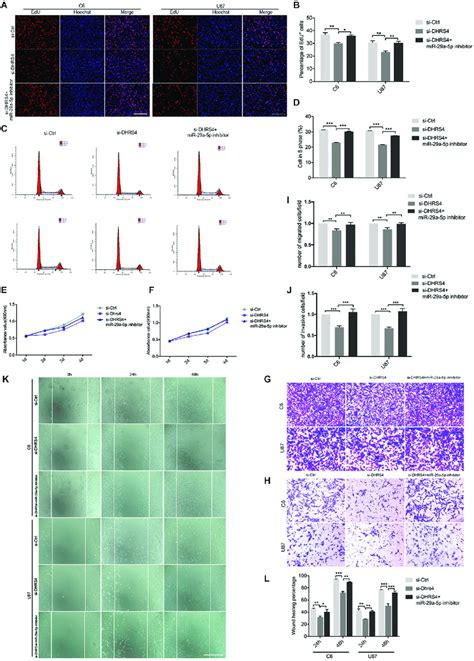 Knockdown Of Dhrs4 Inhibits Glioma Cell Proliferation Invasion And