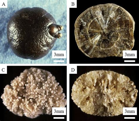 Бөөрний чулуу болон Цөсний ШУА ФТХ Багажит анализын төв