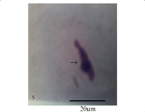 Photomicrograph Of Impression Intestinal Smears From Insect Polyplax