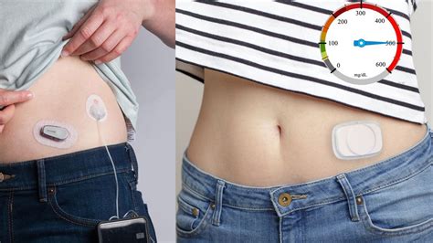 Diabetes Symptoms డయాబెటిస్ ఉన్న వారి రక్తంలో షుగర్ లెవల్ 600 దాటితే
