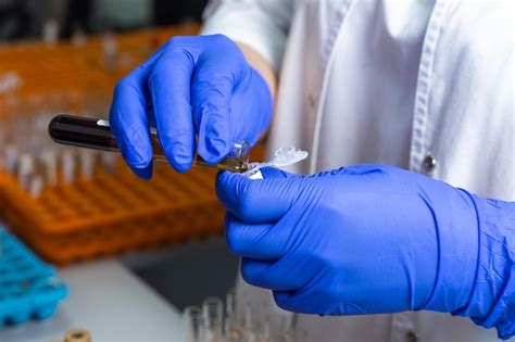 Premium Photo Lab Technicians Work Closeup Mixes Squats In Flask