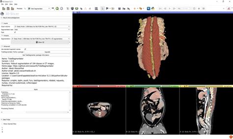 new extension fully automatic whole body ct segmentation in 2 minutes