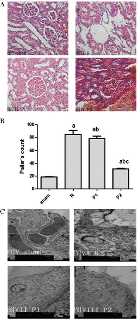 Figure 2 From Effects Of Propofol On Renal Ischemiareperfusion Injury
