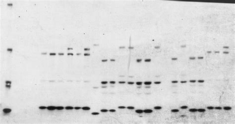 Example Of Binary Typing Of Staphylococcus Aureus Isolates From Bovine Download High