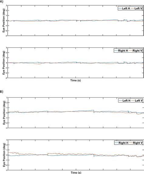 Assessing Binocular Central Visual Field And Binocular Eye Movements In A Dichoptic Viewing