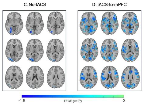 고려대 뇌공학과 민병경 교수 연구팀 뇌 자극이 생각을 바꾼다