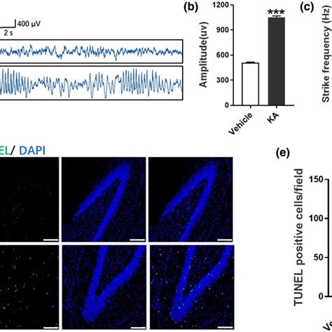 seizure‐like eeg in ka‐induced seizure model a rats treated with