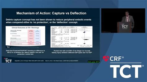 Live Case 1 Redo Tavr New York Presbyterian Hospital Columbia
