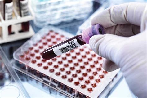 Having An Overactive Immune System May Prime You For Depression New