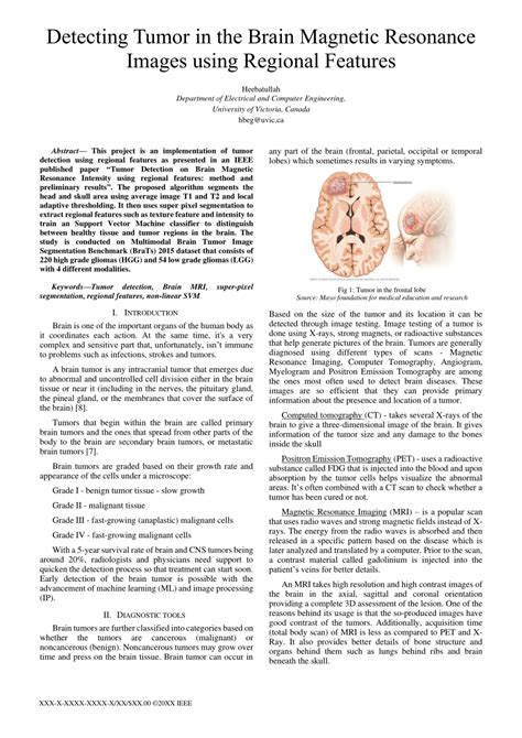 Pdf Detecting Tumor In The Brain Magnetic Resonance Images Using