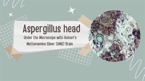 Aspergillus Head Under The Microscope With Gomoris Methenamine Silver