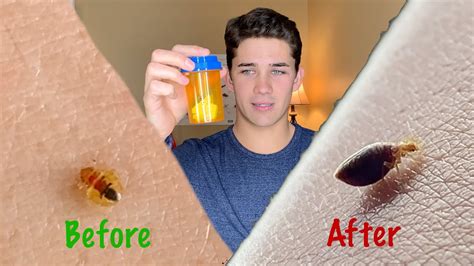 How Long Does It Take For A Bed Bug To Feed Youtube