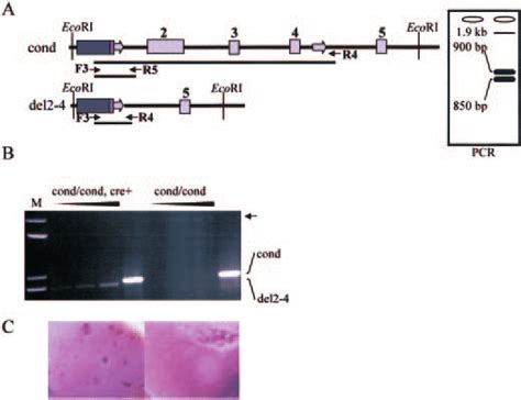Cre Mediated Somatic Loss Of Pkd1 Results In Liver Cysts A Schematic