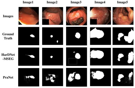 Inference Results Of Kvasir Seg Download Scientific Diagram