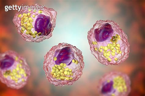 Foam Cell A Macrophage Cell With Lipid Droplets 이미지 1147819823 게티이미지뱅크