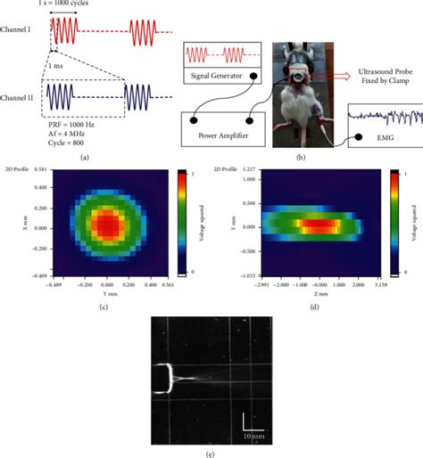 Effects Of Noninvasive Low Intensity Focus Ultrasound Neuromodulation On Spinal Cord