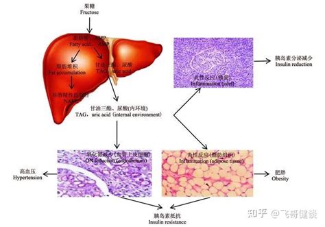 最危险的糖类：果糖 知乎