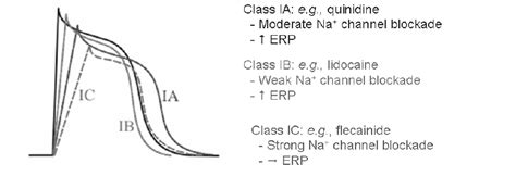 Different Effect Of Typical Class I Antiarrhythmics On Action Potential