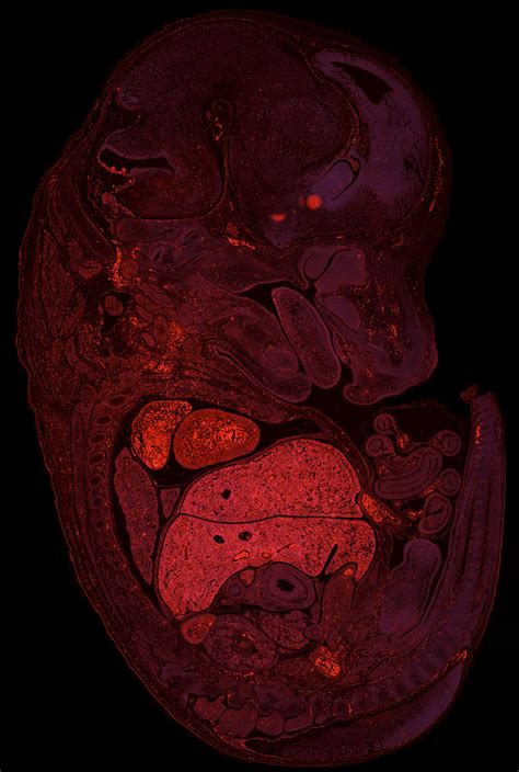 Mouse Embryo Ffpe Section E14 5 Labeled With Integrin Beta 4 Antibody Bicell Blue