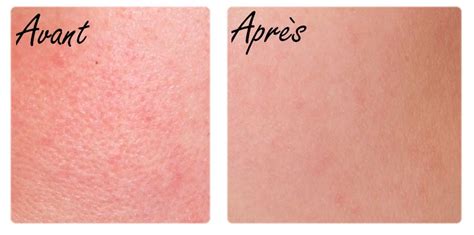 Battle Dream Wonder Nude VS Nude Magique Choup N Beauty