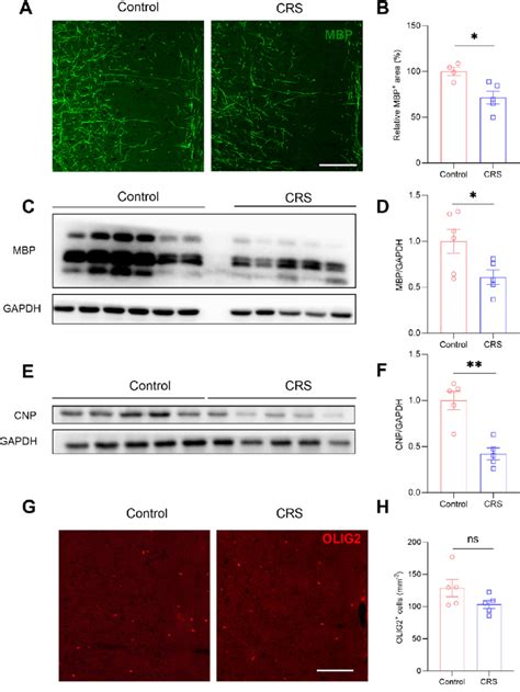 Myelination Disruption In The Pfc Of Crs Mice A Representative Download Scientific Diagram