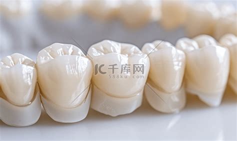 无金属陶瓷牙冠高清摄影大图 千库网