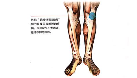 损伤恢复膝盖骨软化症跑步者膝盖痛 知乎