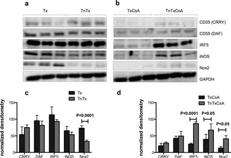 Time Course Of Dsa And Complement Fixing Alloantibodies In Sensitized