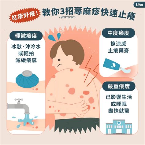蕁麻疹會自己好嗎是身體在排毒教你快速止癢法多吃它可緩解 Uho優活健康網