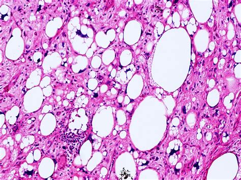 Pathology Links Pathology Resident Wiki Fandom