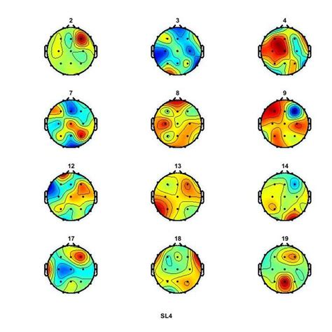 the scalp maps obtained from ica analysis 19 download scientific diagram