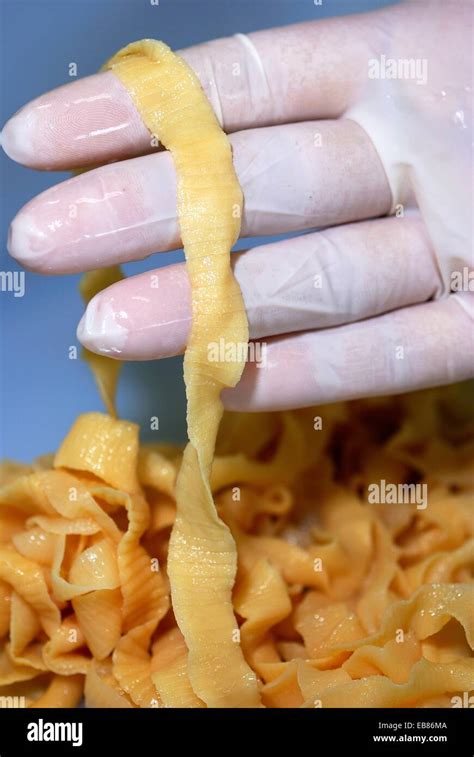 Tapeworm Taenia Saginata