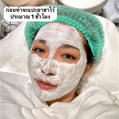รวมรีวิว Pico Laser รักษาหลุมสิว รอยสิว รอยดำ ที่ The Ritz Clinic