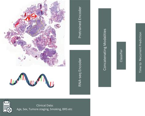 Task 3 Bladder Cancer Recurrence Prediction Chimera Grand Challenge