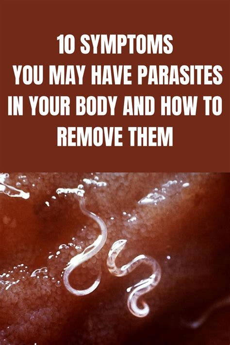 10 Symptoms You May Have Parasites In Your Body And How To Remove Them