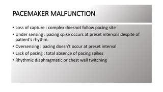Pacemaker Pptx