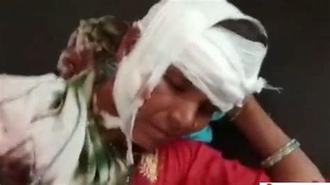 सीतामढ़ी बकरी चराने की विवाद में दबंगों ने 3 महिलाओं को पीटा इलाजरत