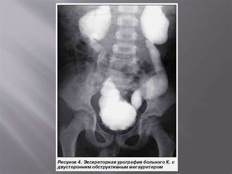 Рентгенологические методы исследования заболеваний почек и мочевыводящих путей в педиатрии