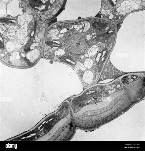 Leaf Epidermis Transmission Electron Micrograph Tem Of A Section Through The Lower Epidermis