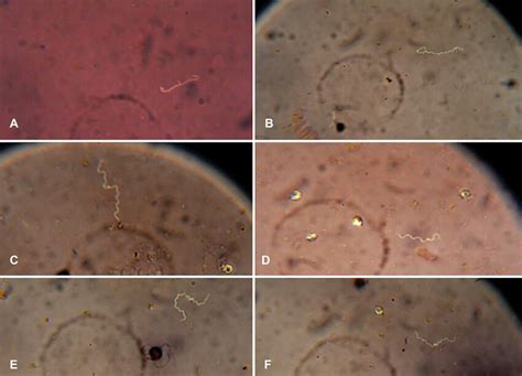 Microscopic Observation Of Leptospira With A 100× Magnification Optical