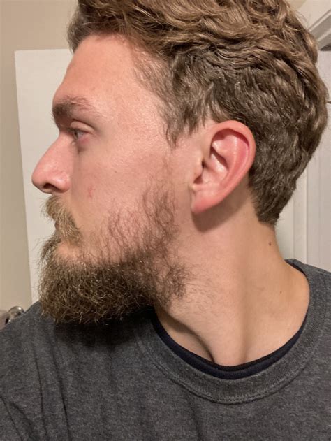 Beard Adventure From Patchy To Short To Long Page 2 Beard Board
