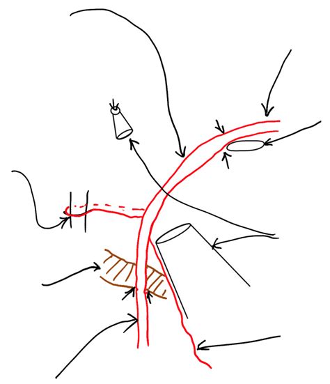 Axillary Artery Diagram Diagram Quizlet