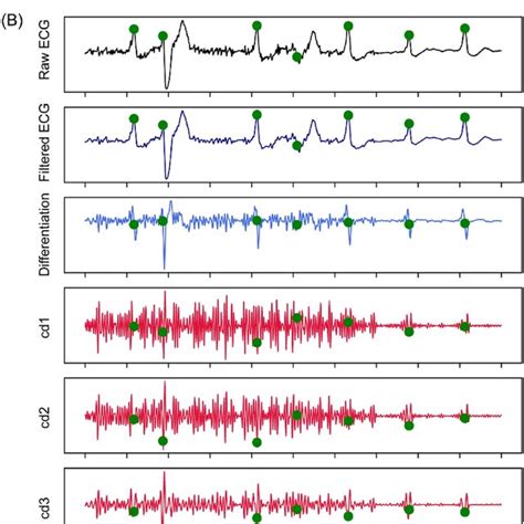 The Swt Process According To The Decomposition Levels The Ecg Record
