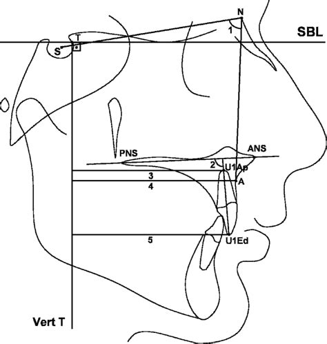 Cephalometric Landmarks Angular And Linear Measurements Sella S